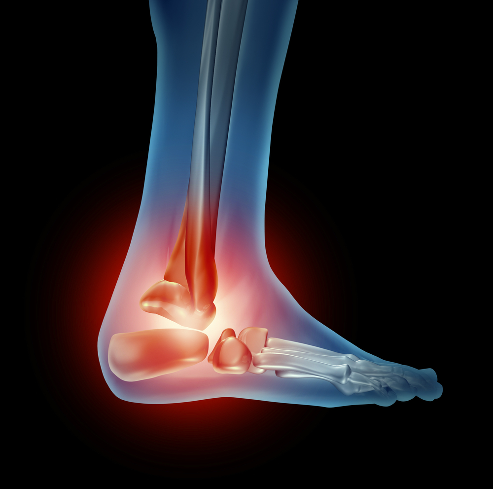 What Are the Causes of Arthritis in the Foot? - Island Foot Clinics