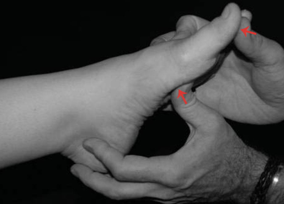 Fhl examination and associated symptoms - Island Foot Clinics